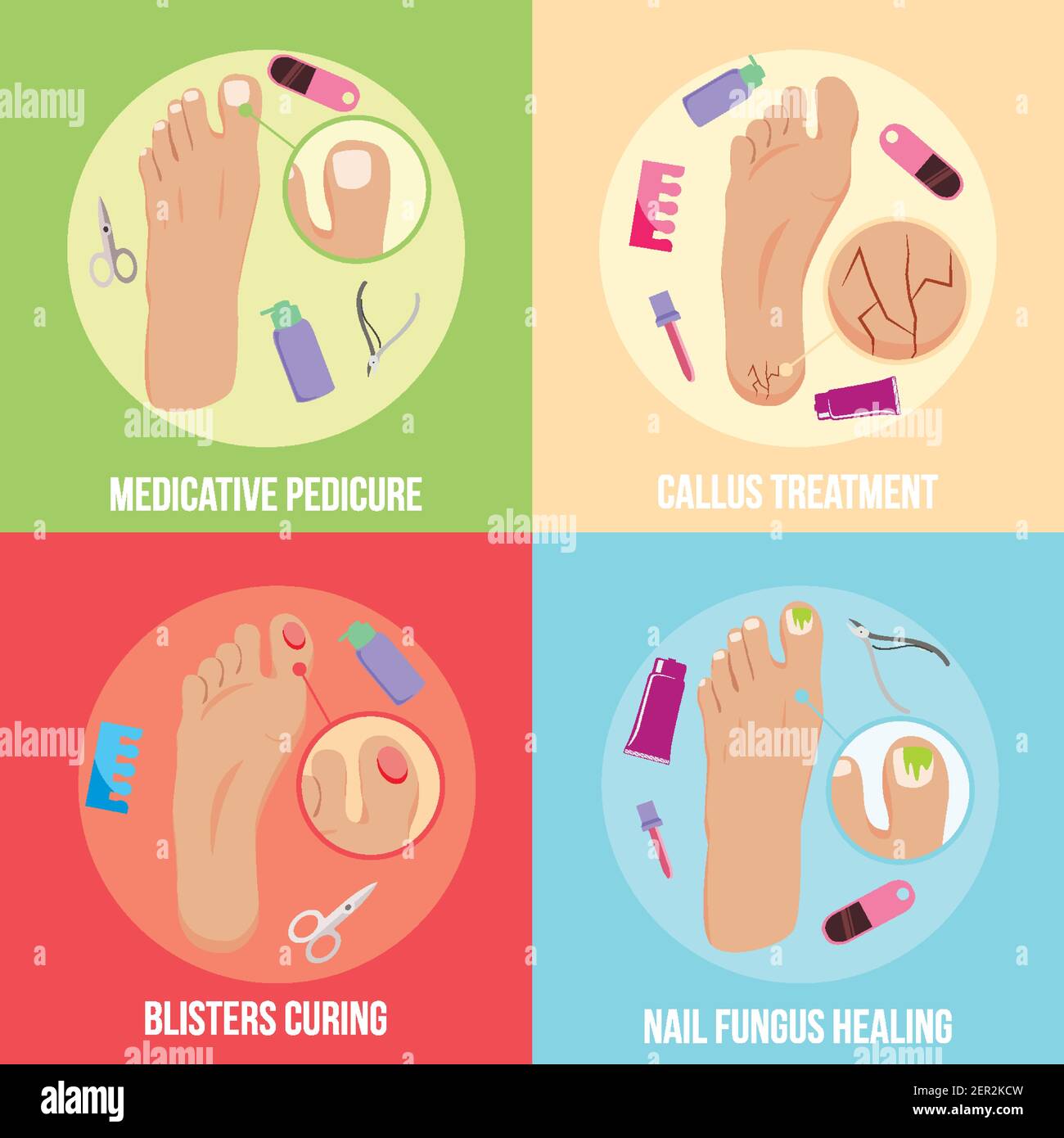 Foot problems flat design concept medicative pedicure treatment of ...