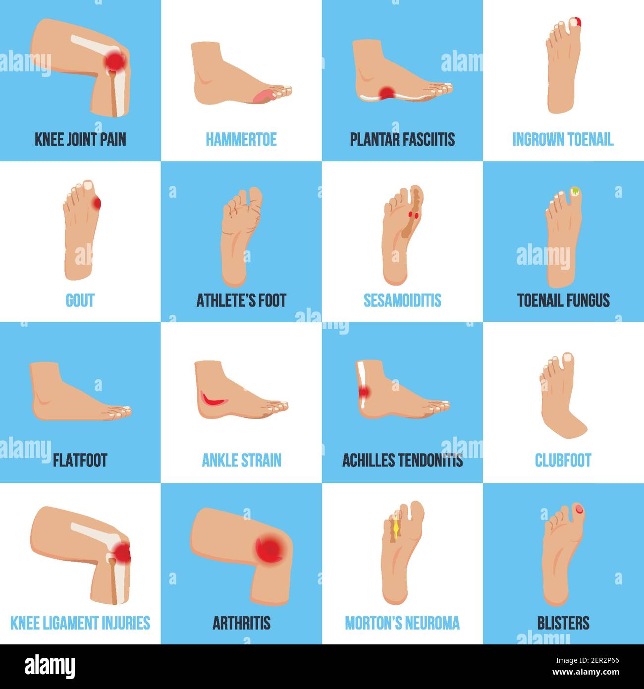 Set of flat icons with foot problems on white blue background isolated ...