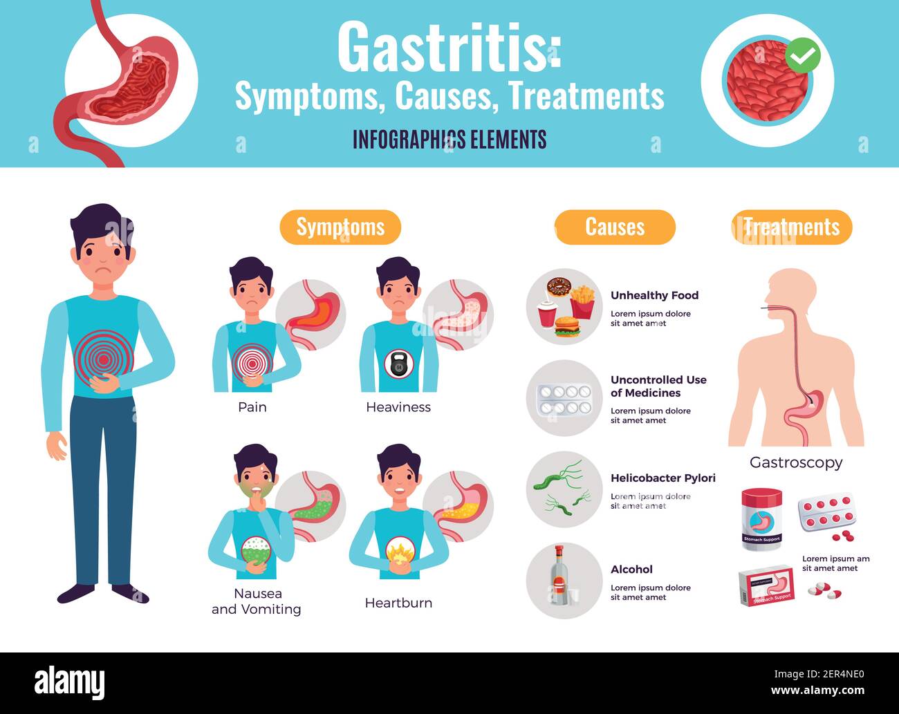 Gastritis symptoms causes treatments comprehensive infographic poster with unhealthy food ...