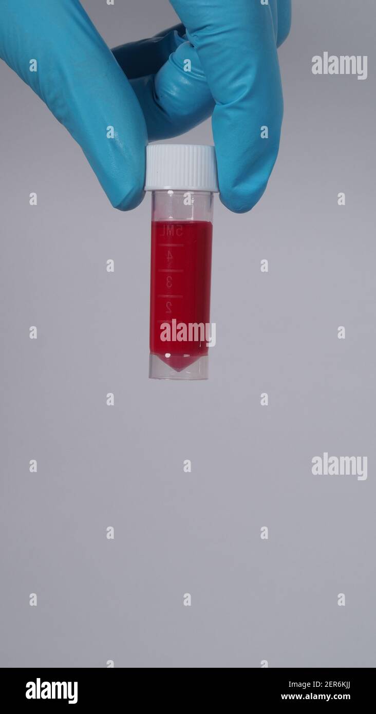 Blood tube. Covid 19 Test. doctor hand holding a blood sample tube for ...