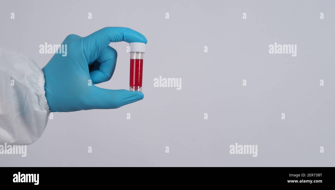 Blood tube. Covid 19 Test. doctor hand holding a blood sample tube for ...