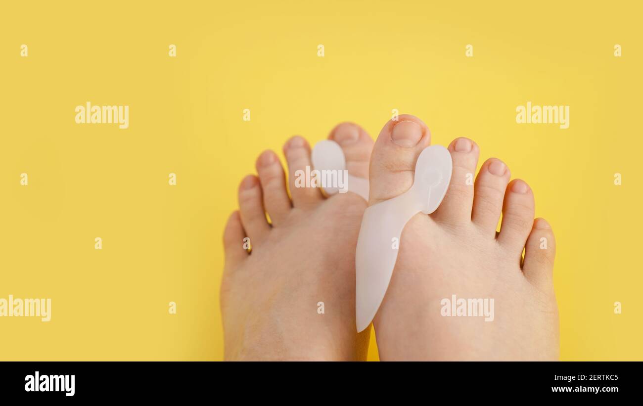 Silicone finger separator. Orthopedic thumb corrector. Legs on a bright ...