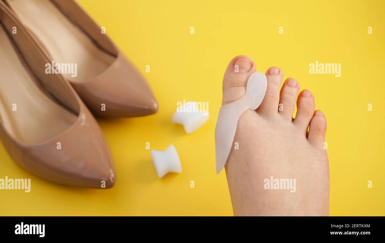 Treatment and prevention of hallux valgus. Silicone finger separator ...