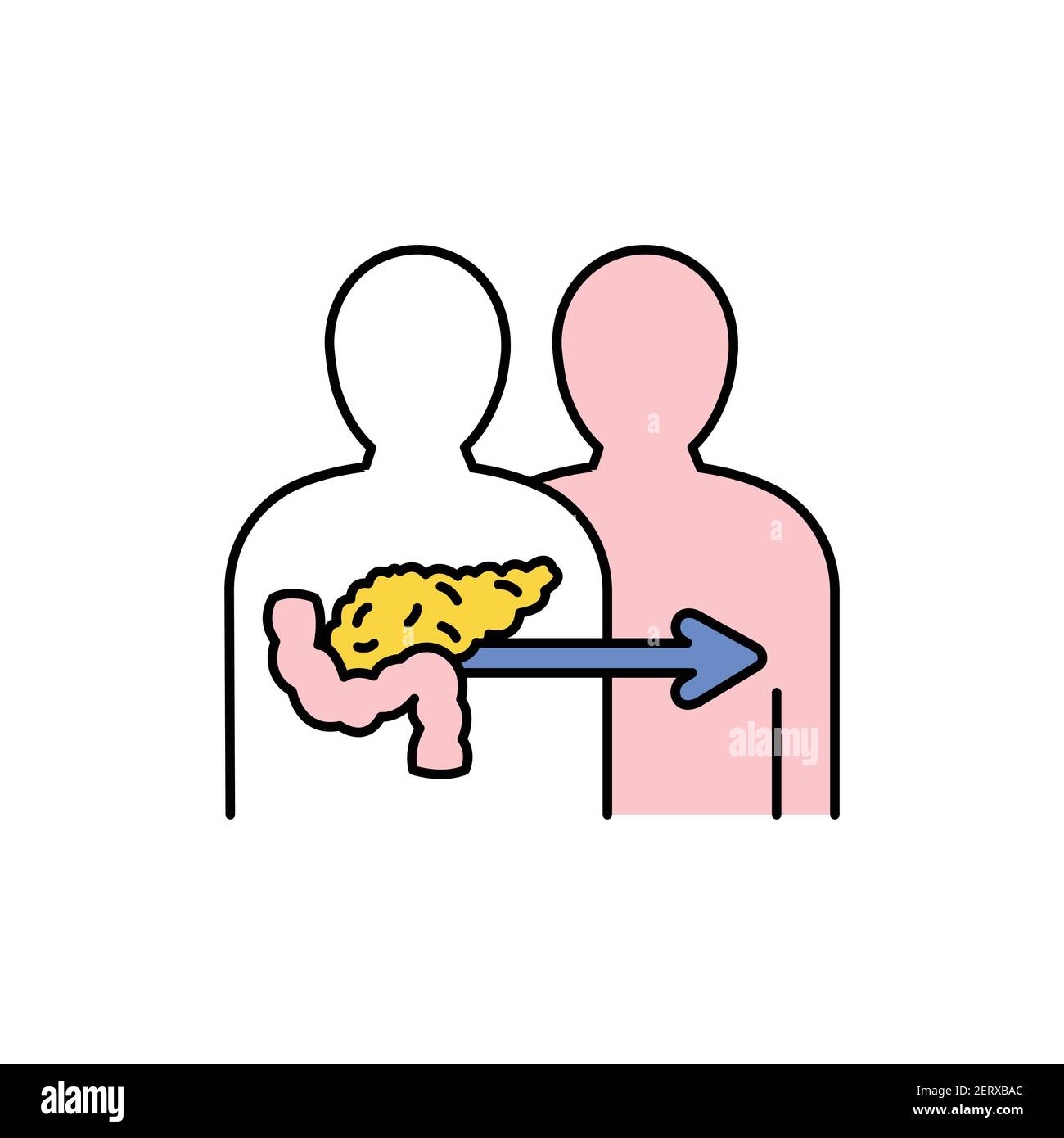 Pancreas transplant color line icon. Donor organ. Pictogram for web ...