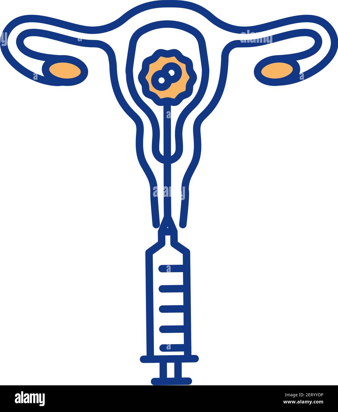 Artificial insemination RGB color icon Stock Vector Image & Art - Alamy Artificial insemination RGB color icon Stock Vector Image & Art - Alamy