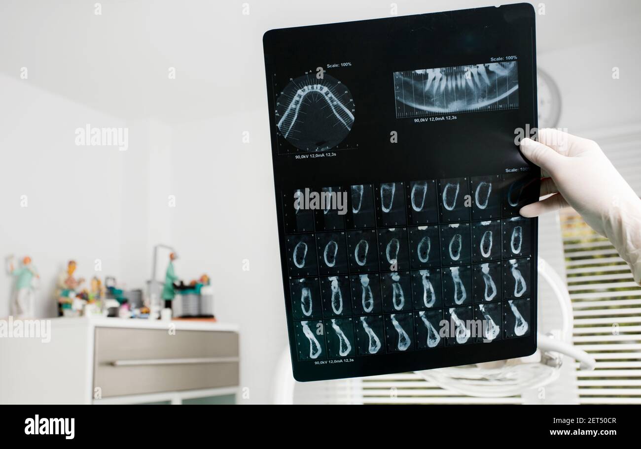 dental doctor, oral x-ray exams (oral radiography), dental clinic ...