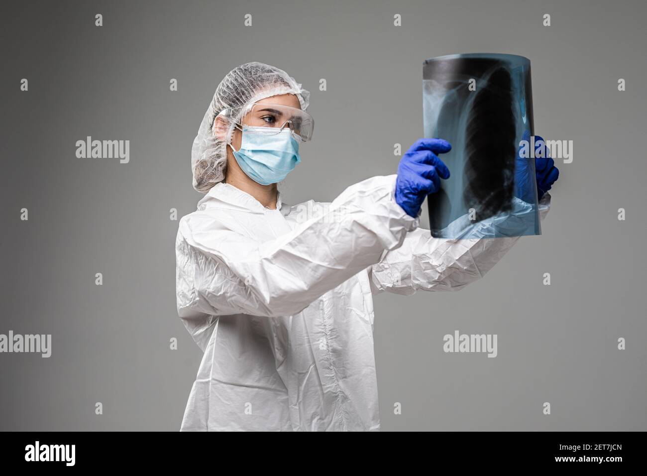Female pulmonologist or oncologist holding chest X-ray scan,inspecting ...