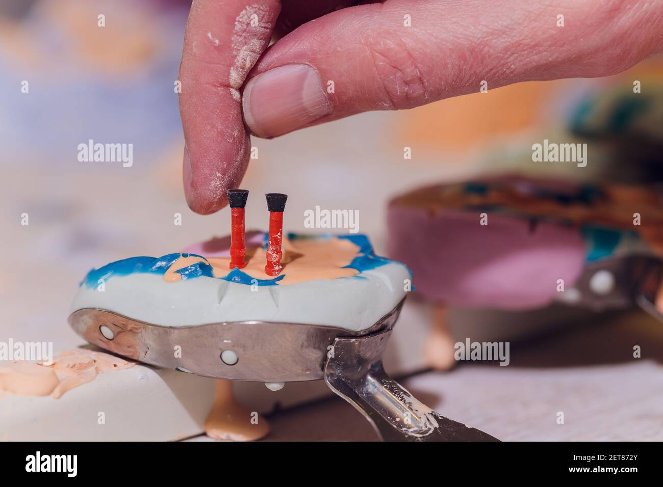 The process of making a dental prosthesis in a dental laboratory Stock ...