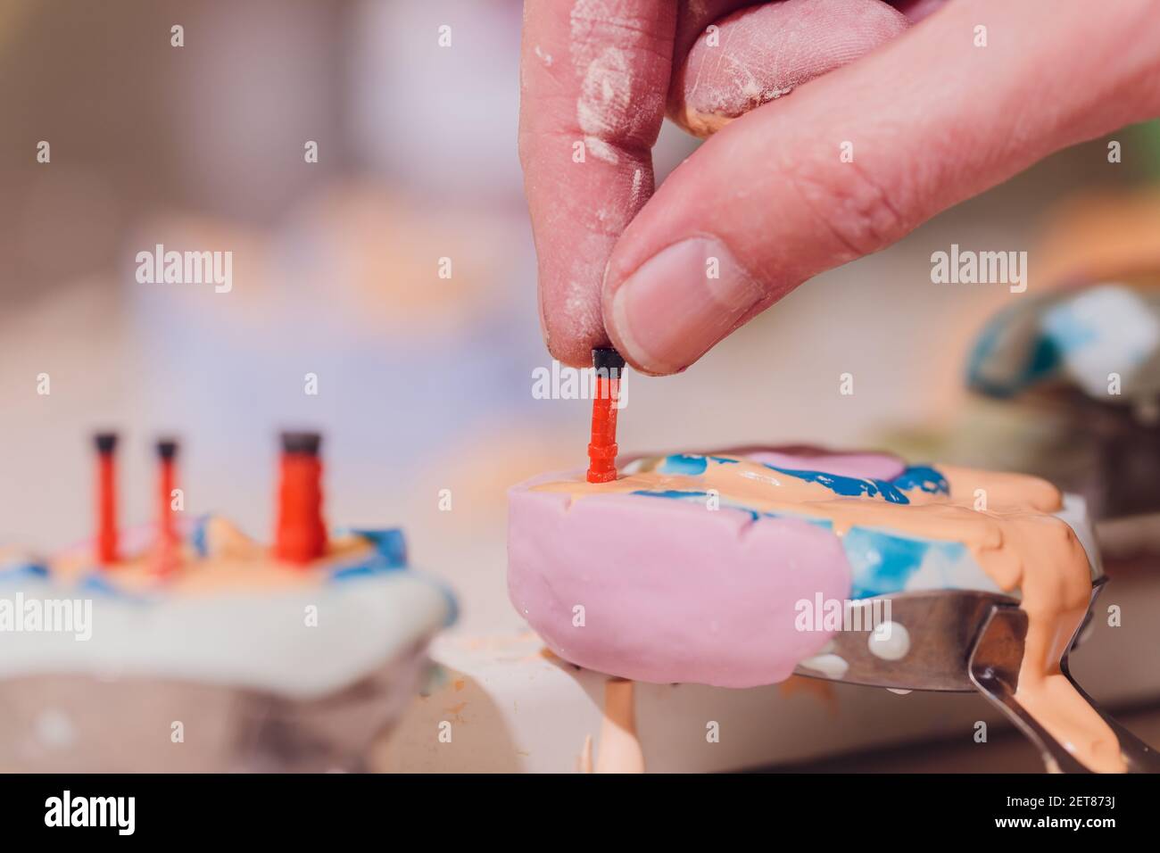 The process of making a dental prosthesis in a dental laboratory Stock ...
