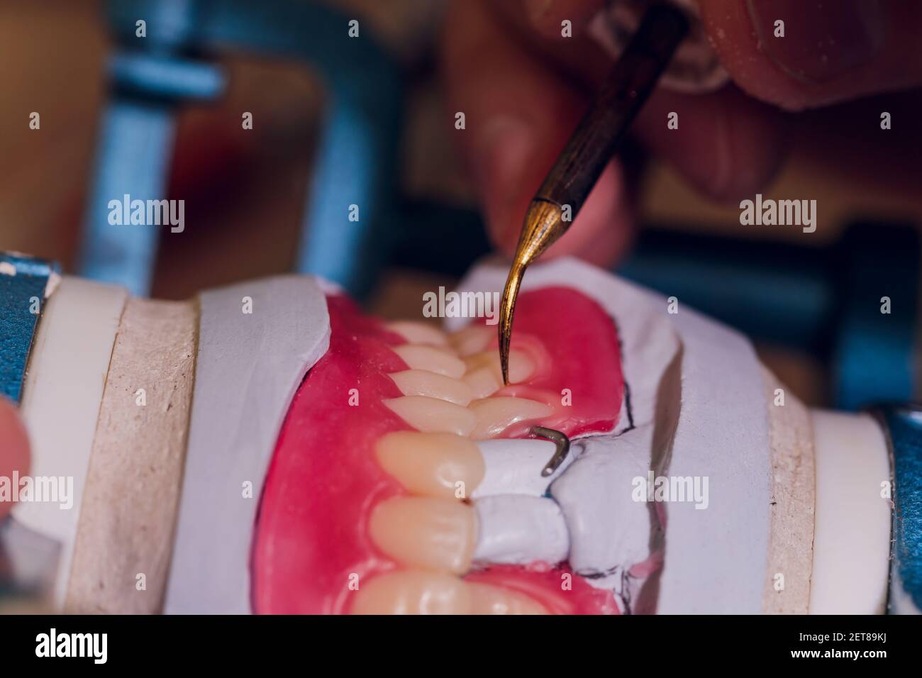 The process of making a dental prosthesis in a dental laboratory Stock ...