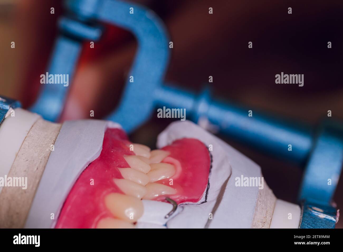 The process of making a dental prosthesis in a dental laboratory Stock ...