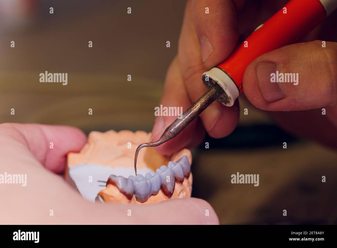 The process of making a dental prosthesis in a dental laboratory Stock ...