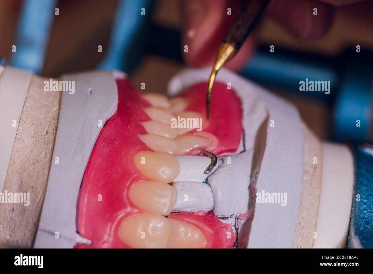 The process of making a dental prosthesis in a dental laboratory Stock ...
