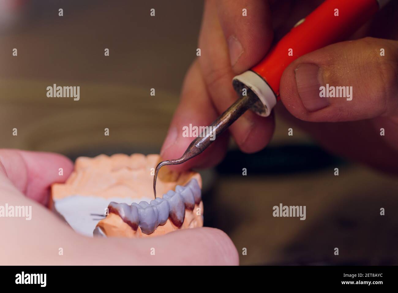 The process of making a dental prosthesis in a dental laboratory Stock ...