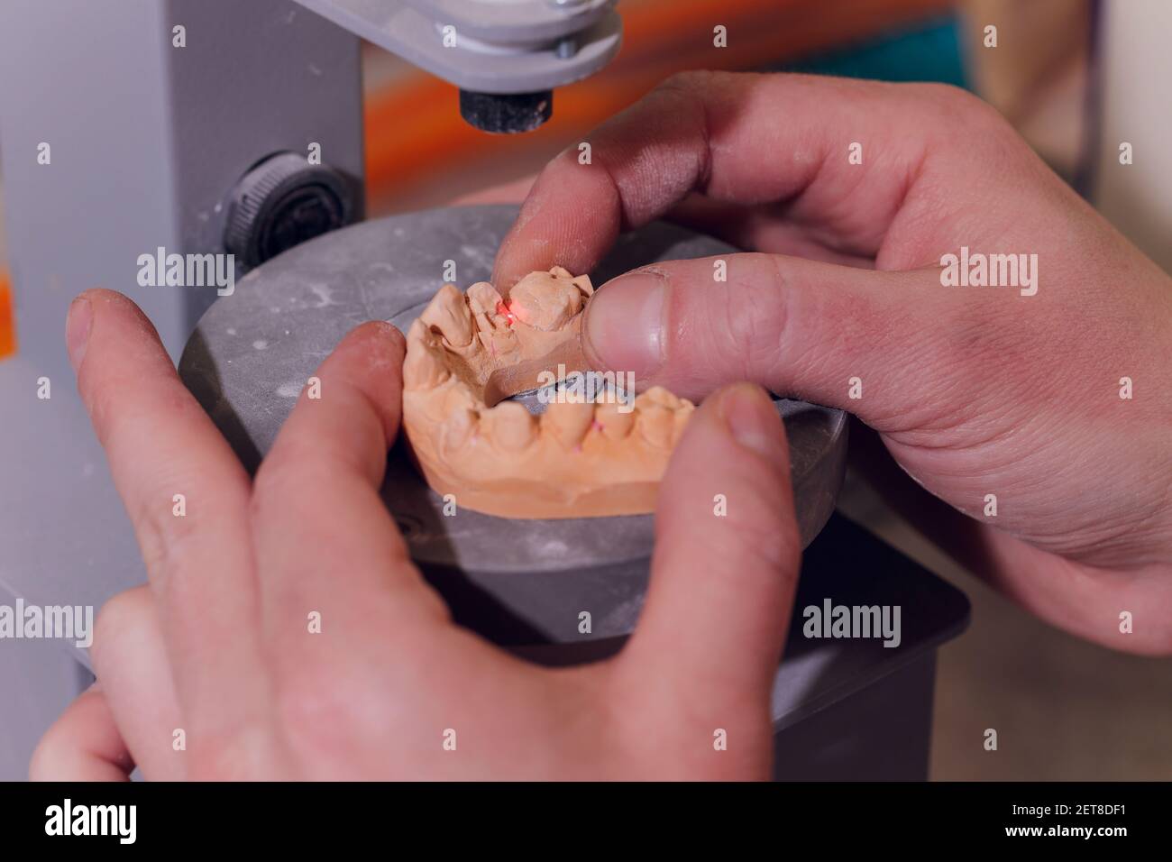 The process of making a dental prosthesis in a dental laboratory Stock ...