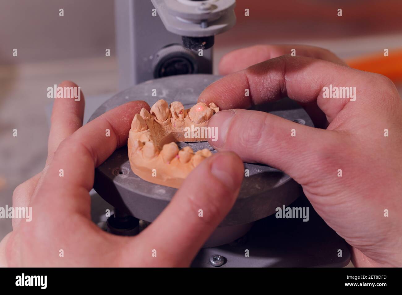 The process of making a dental prosthesis in a dental laboratory Stock ...