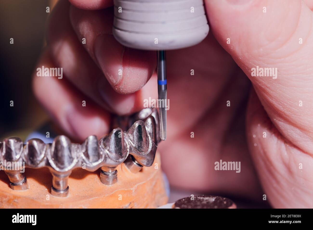 The process of making a dental prosthesis in a dental laboratory Stock ...
