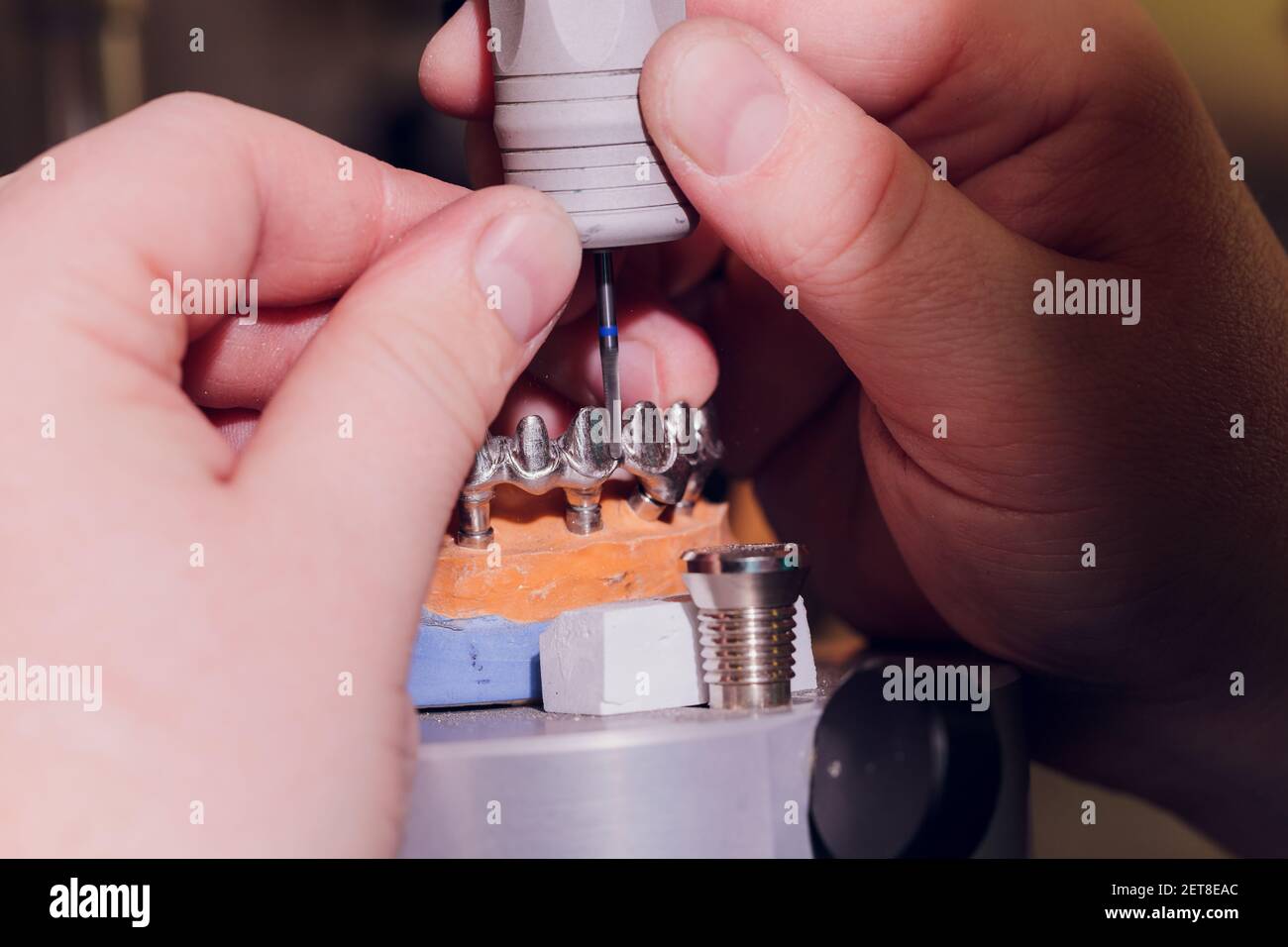 The process of making a dental prosthesis in a dental laboratory Stock ...