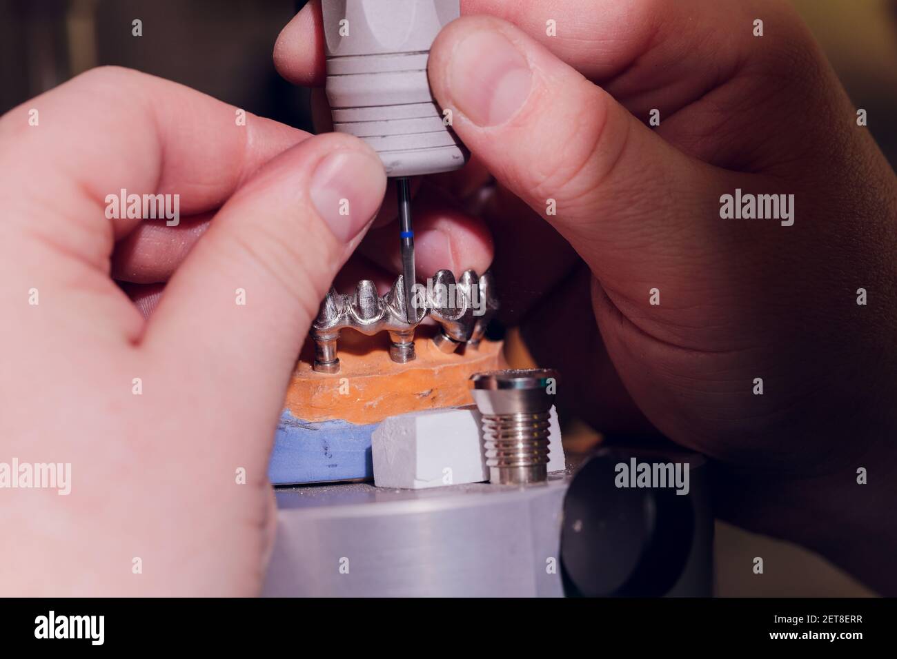 The process of making a dental prosthesis in a dental laboratory Stock ...