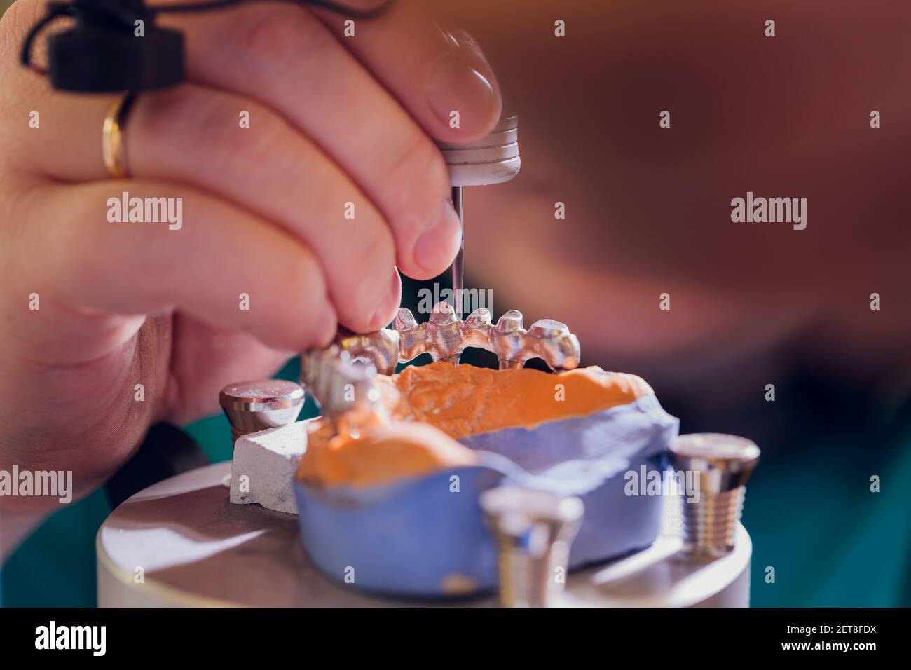 The process of making a dental prosthesis in a dental laboratory Stock ...