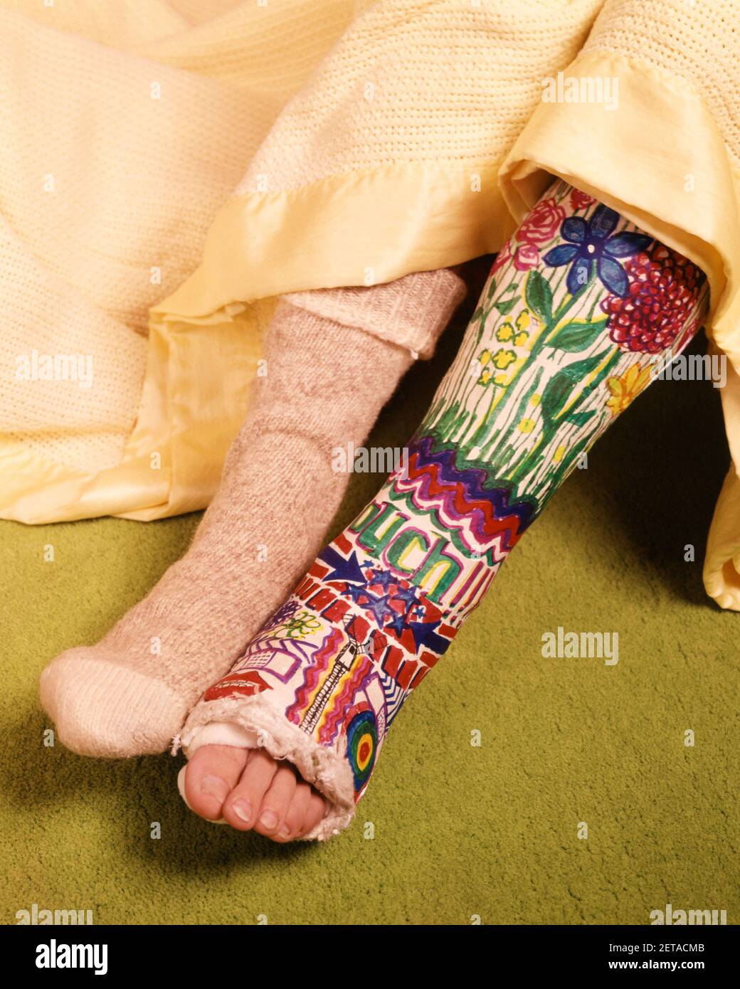 Colorful Cast Plaster High Resolution Stock Photography and Images - Alamy