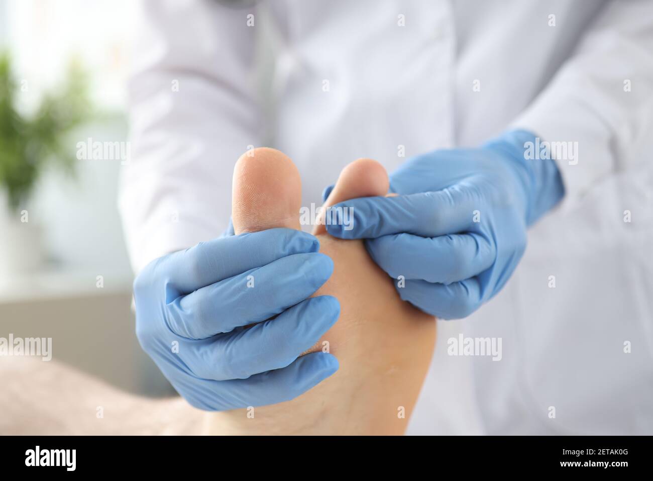 Gloved doctor examines patient's skin on leg between toes Stock Photo ...