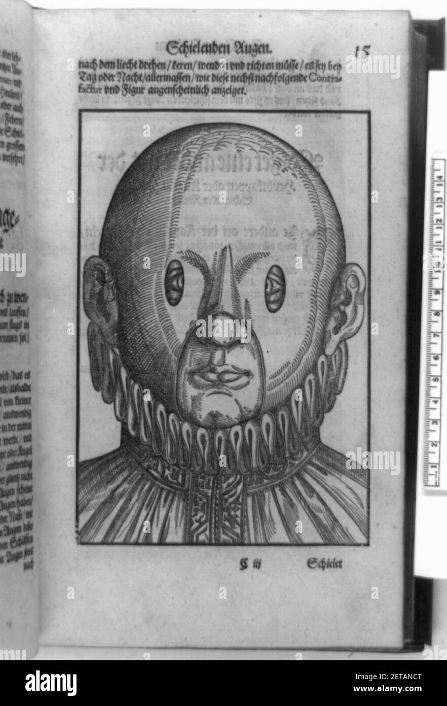 Person with crossed eyes wearing corrective mask, head-and-shoulders ...