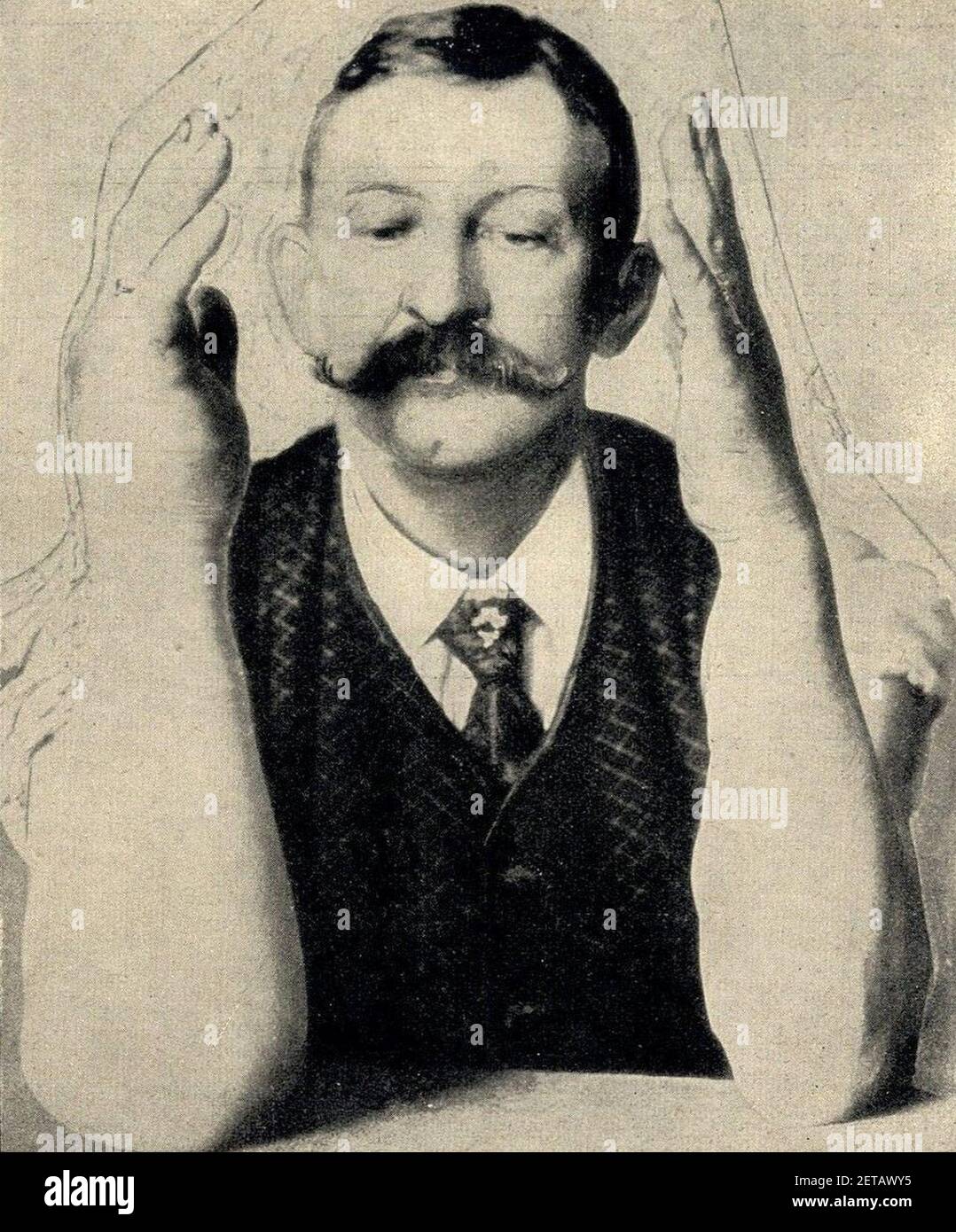 Rechter arm hi-res stock photography and images - Alamy