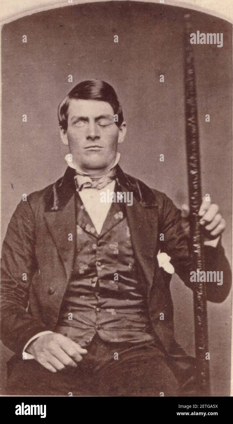 Phineas Gage GageMillerPhoto2010-02-17 Unretouched Color Cropped Stock ...