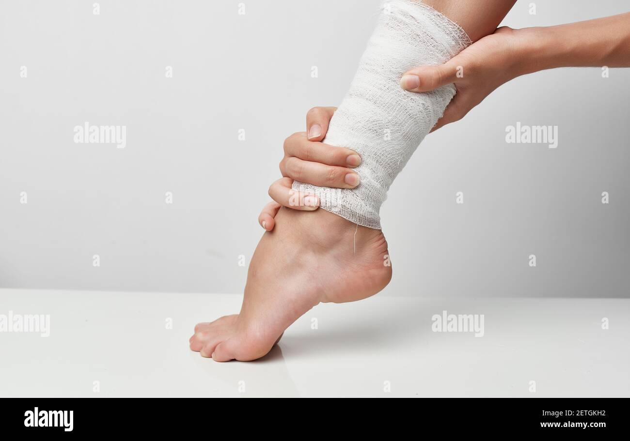summer injury female leg bandage health problems pain Stock Photo - Alamy