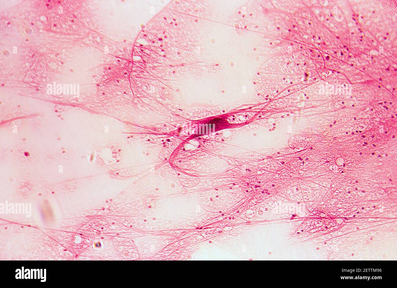 Neuron Tissue High Resolution Stock Photography and Images - Alamy