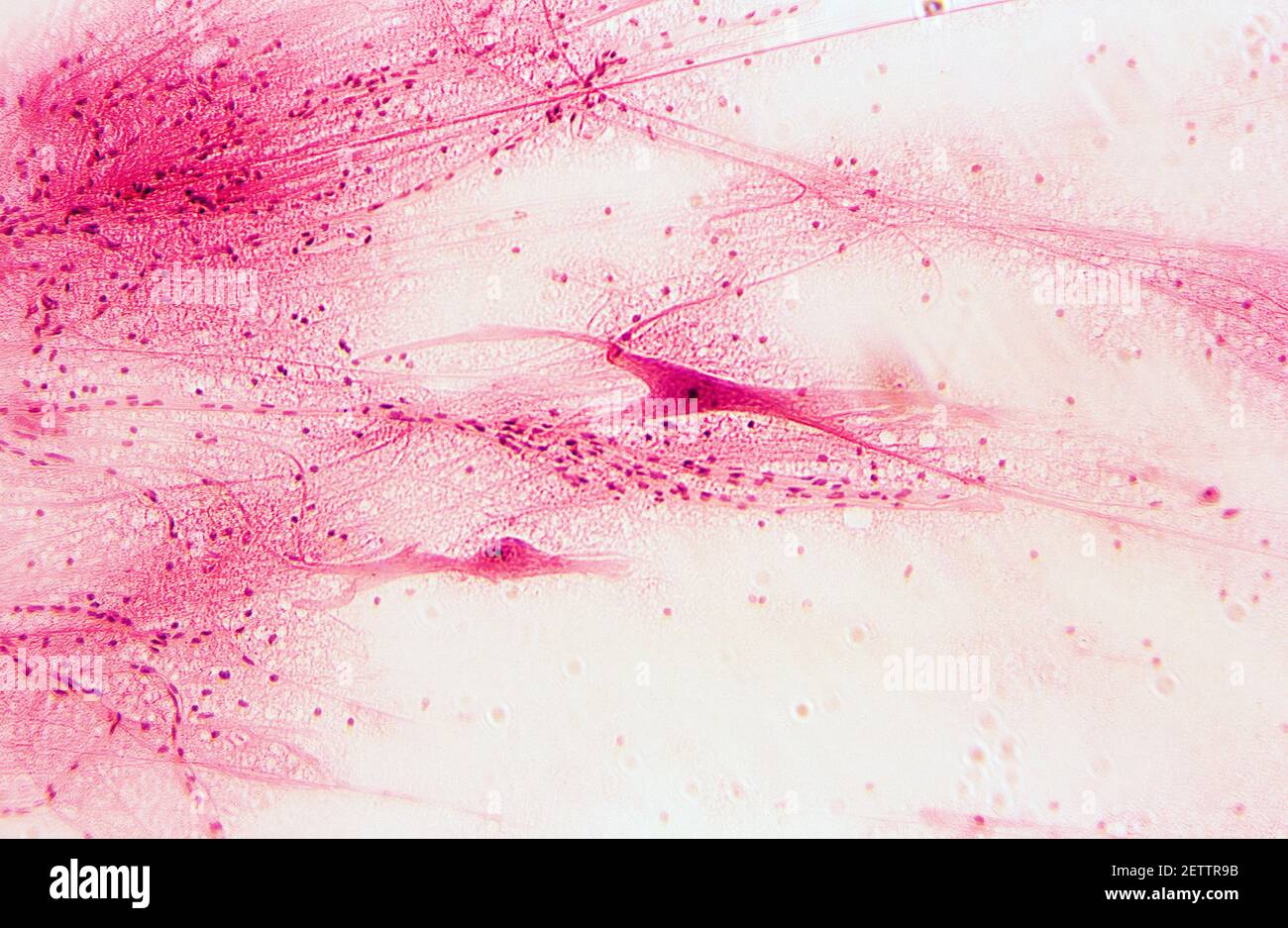 Neuron Tissue High Resolution Stock Photography and Images - Alamy
