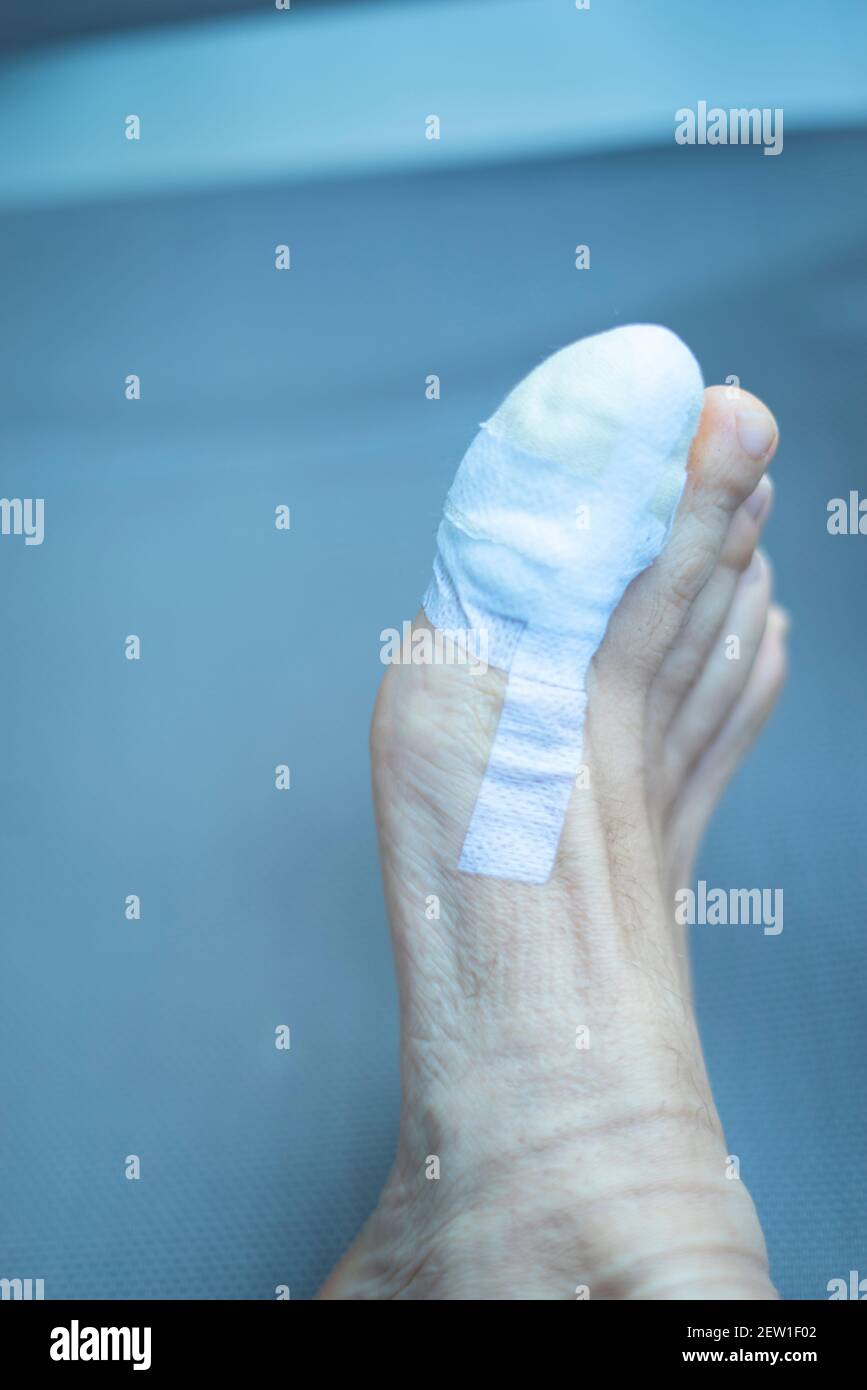 Foot big toe bandage injured feet in medical clinic hospital center ...