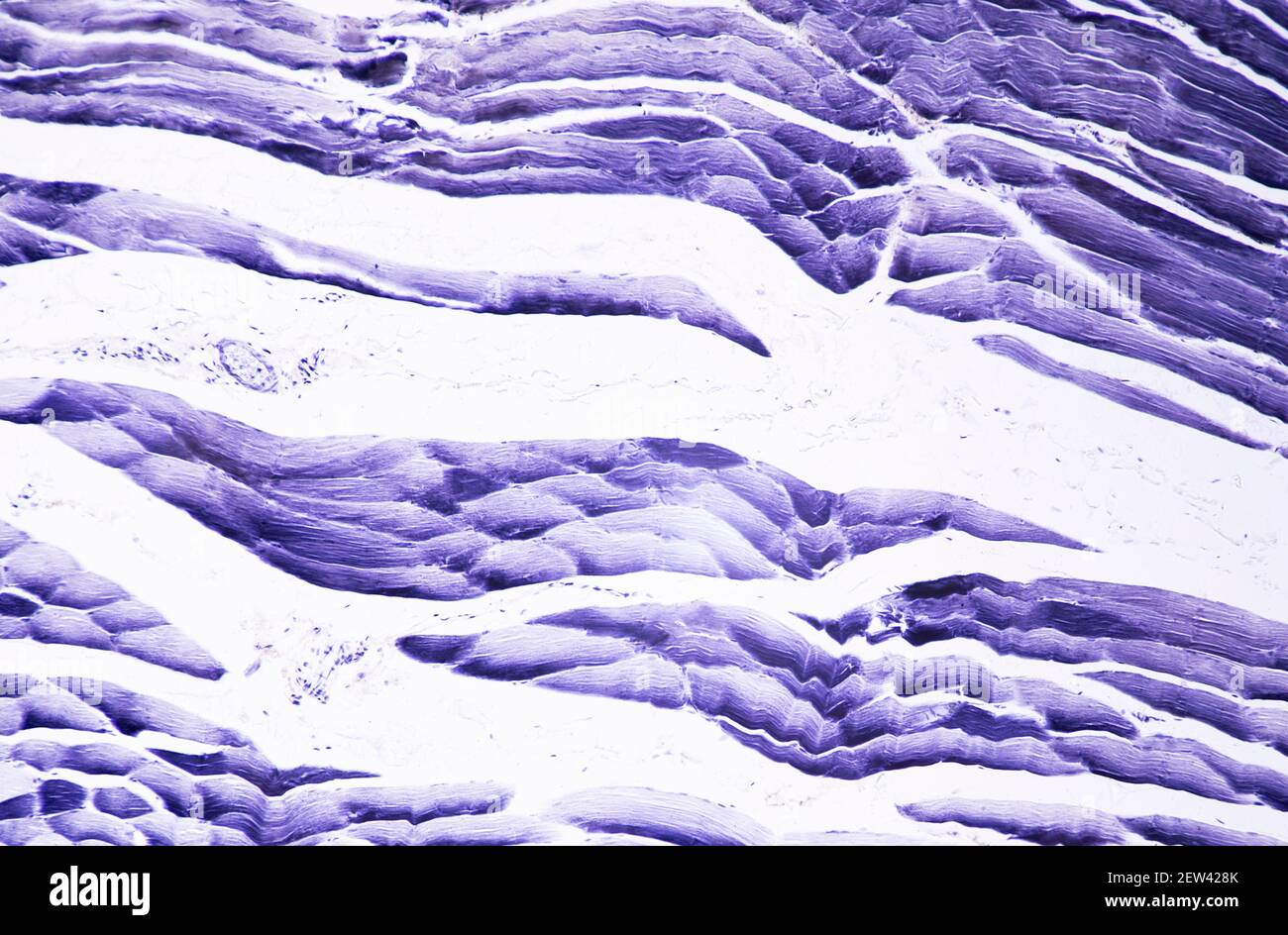 striated muscle viewed under a light microscope at 10 times ...