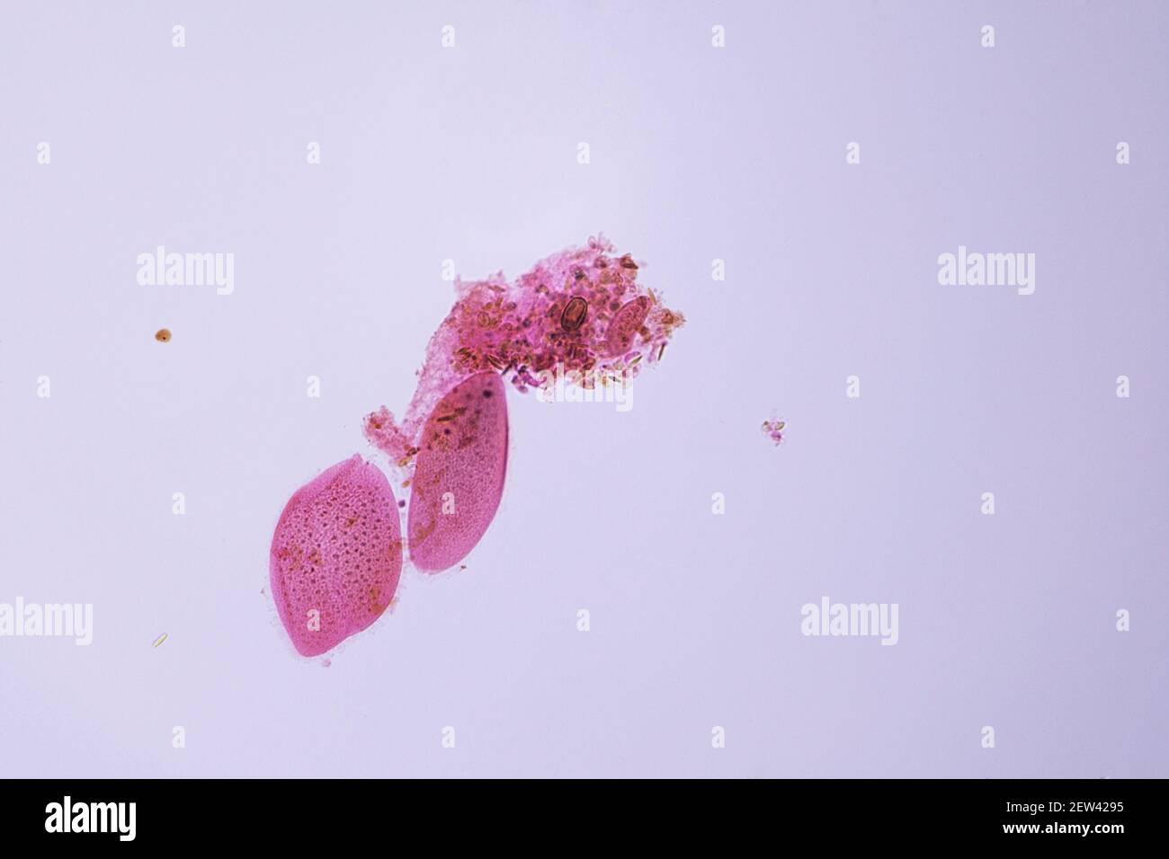 Protozoa Under Microscope 10x