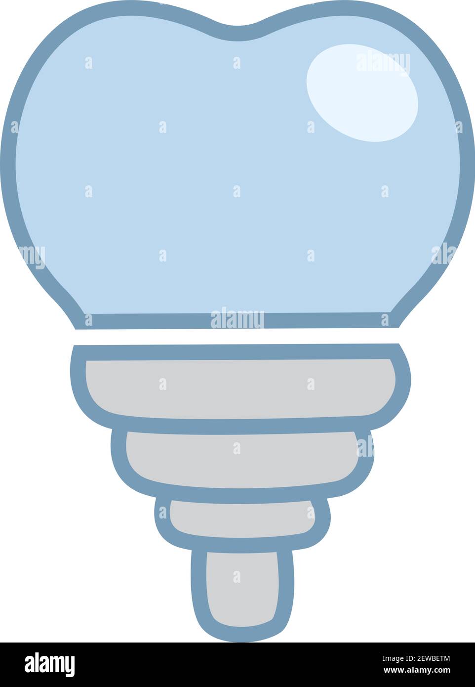 Tooth implant molar on hi-res stock photography and images - Alamy