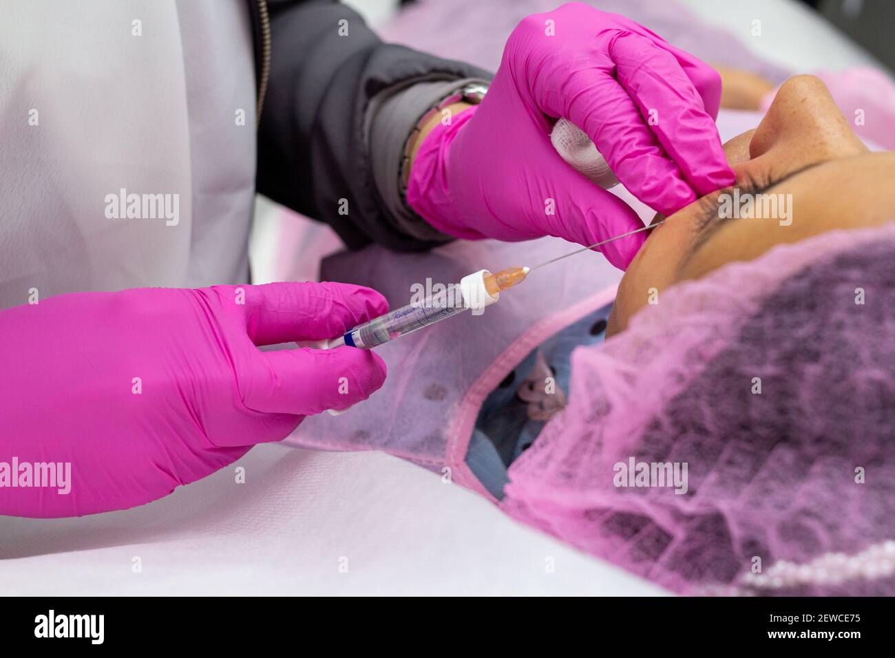 A closeup injection on a young woman's face to tighten the skin and ...