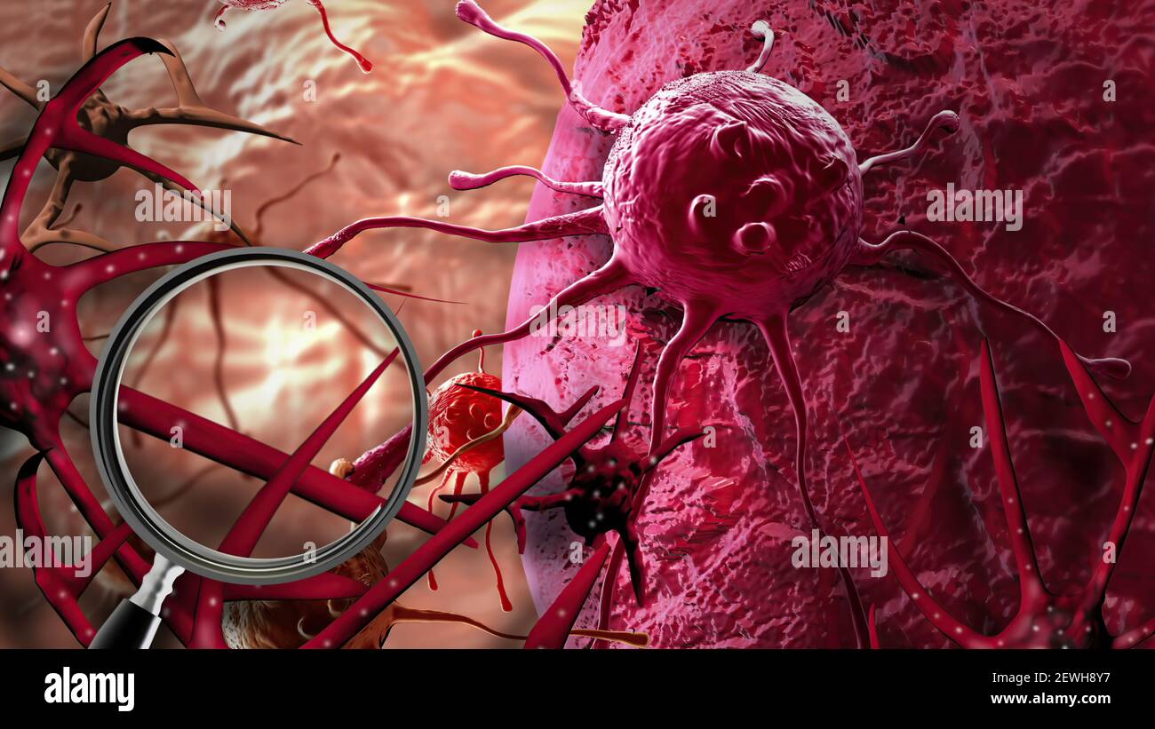 3D illustration - Concept of Cancer Cell in human body Stock Photo - Alamy