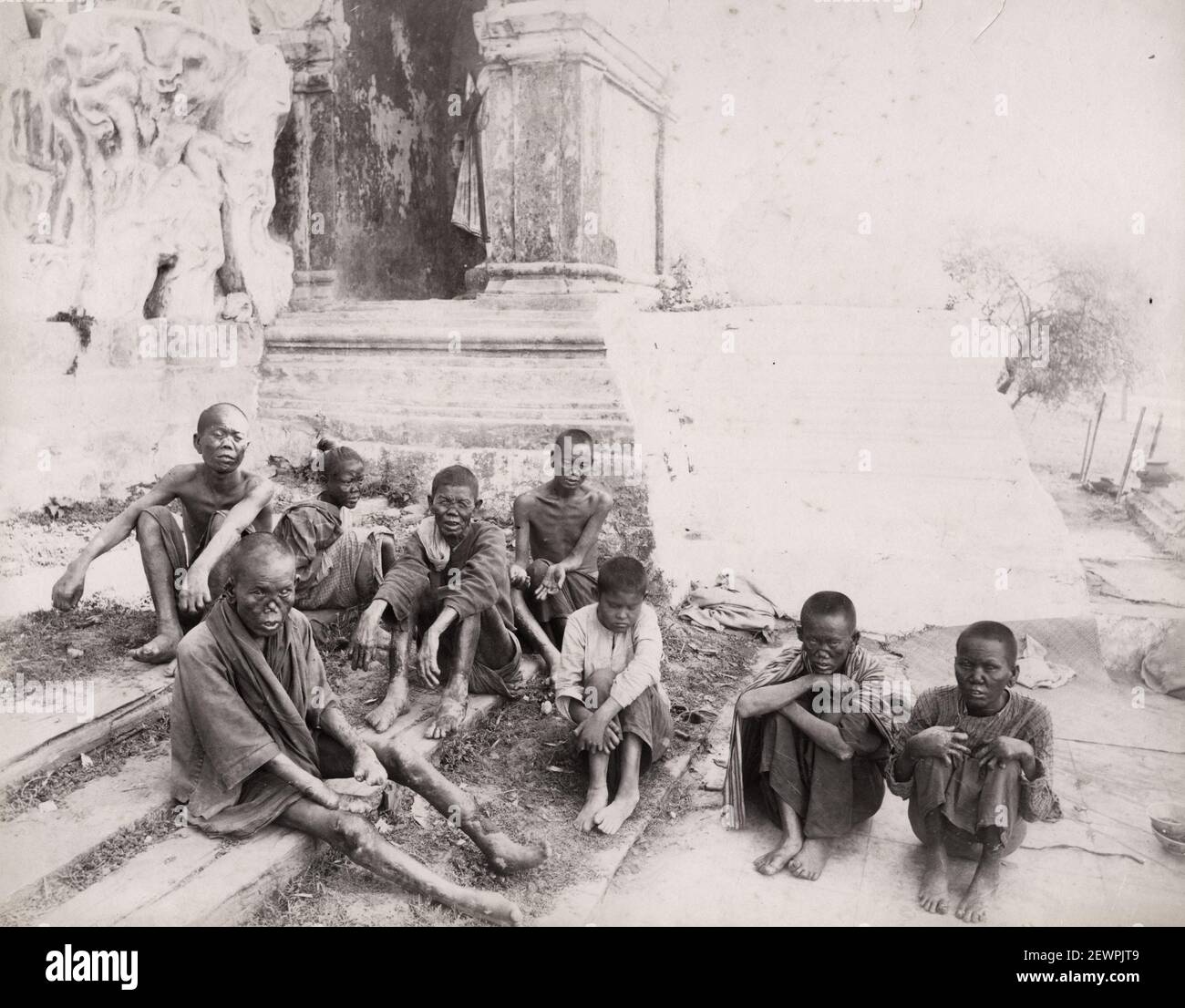 Vintage late 19th century photograph: Lepers, suffers of Leprosy ...