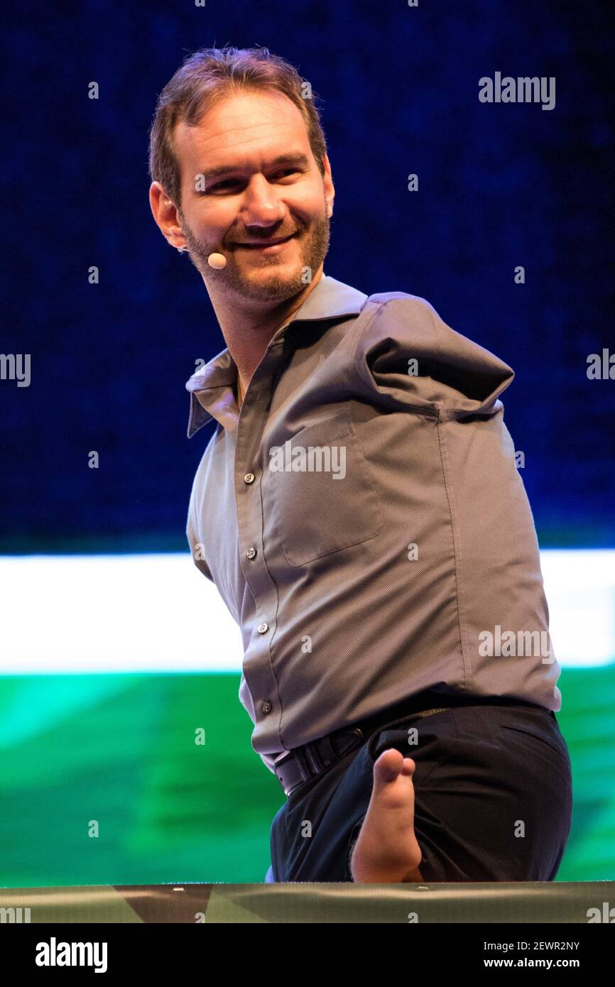 Tetra Amelia Syndrome