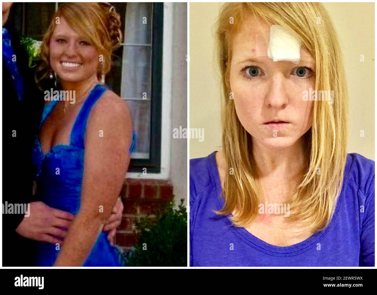 As a teenager in Kansas, it was normal to tan frequently before every ...