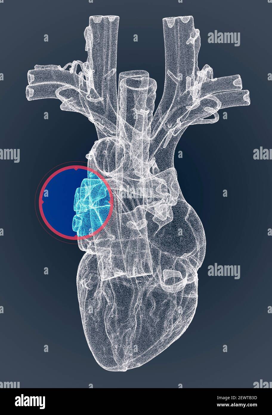 Heart, ventricles, human anatomy, cardiac ventricles. Human body ...