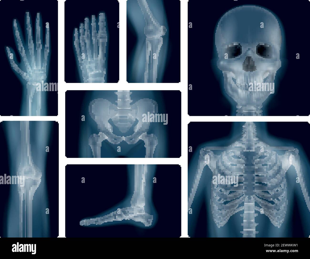 Real Skeleton Pelvis