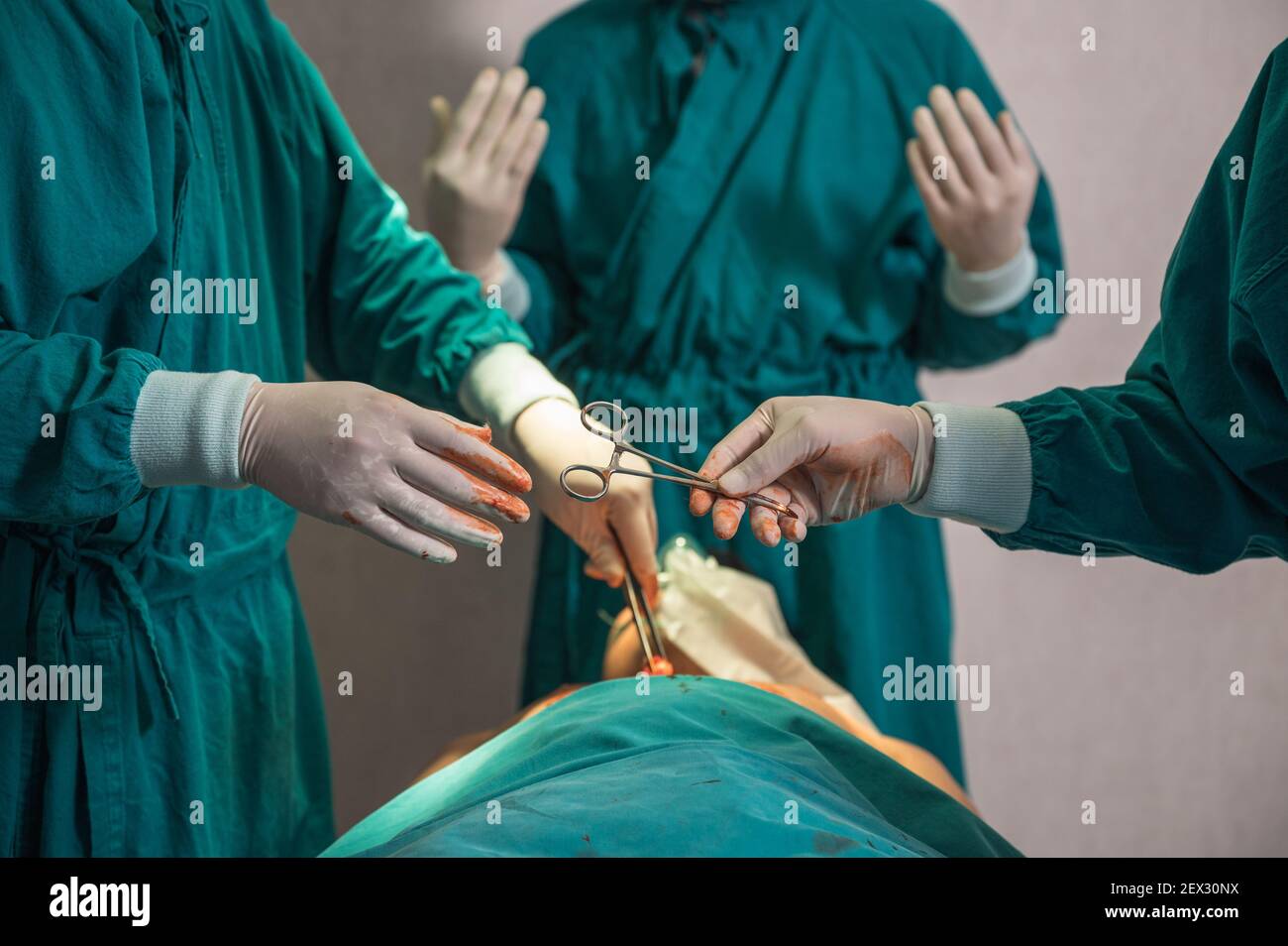Surgeons team performing surgery and passing surgical scissors on ...