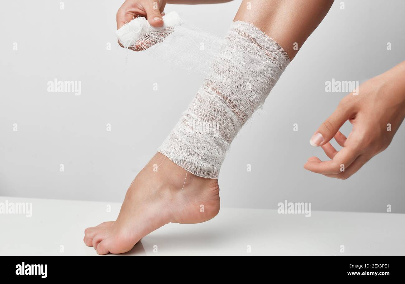 summer injury female leg bandage health problems pain Stock Photo - Alamy