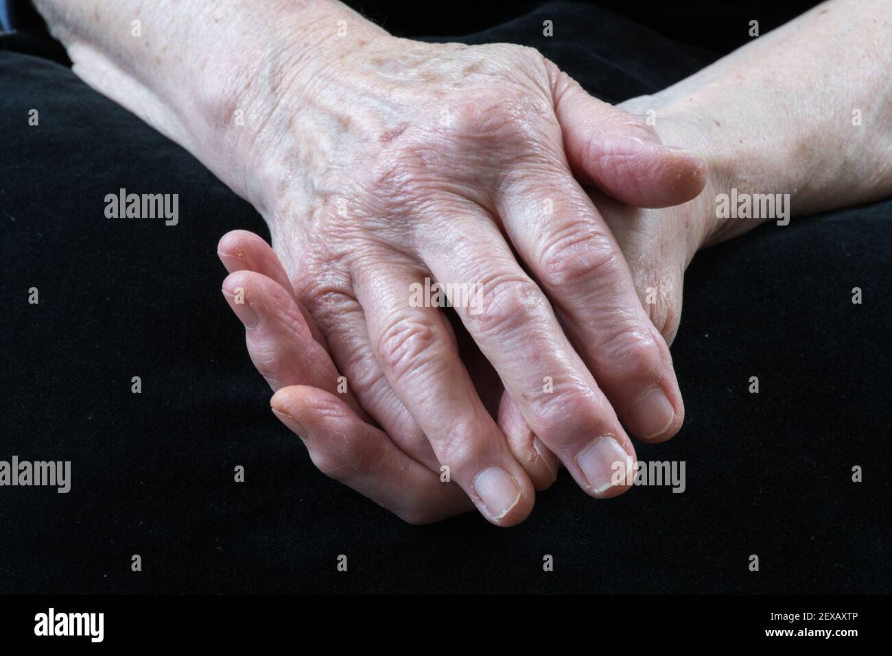 Fat finger joints hi-res stock photography and images - Alamy