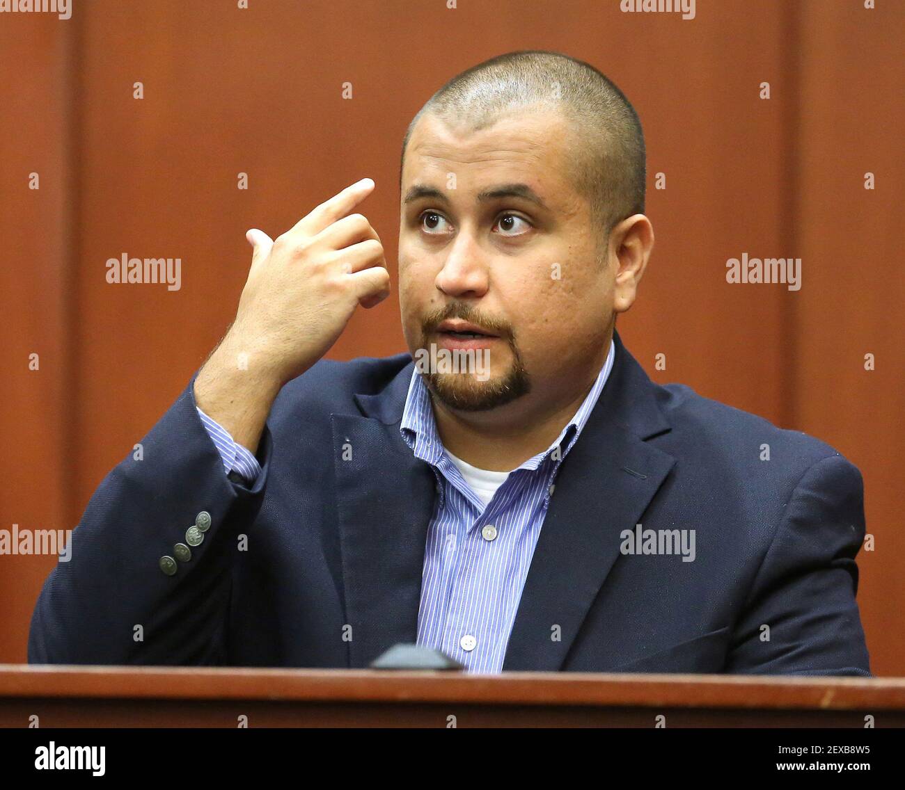 George Zimmerman Wounds