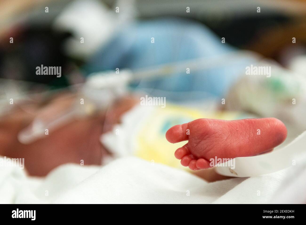 The tiny pink foot of a premature baby at the neonatal intensive-care ...