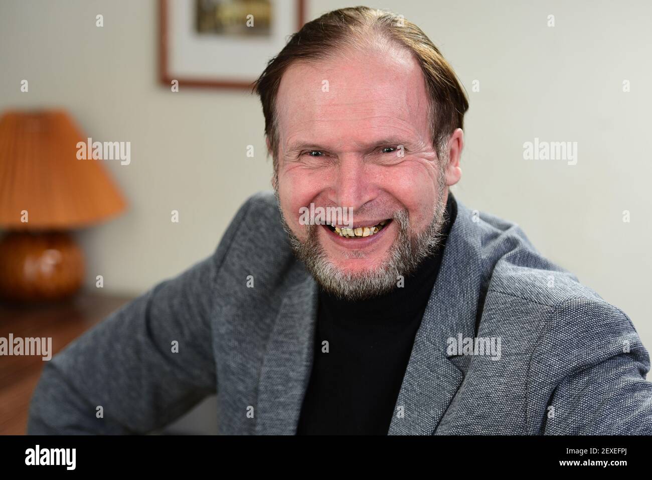 Broken teeth hi-res stock photography and images - Alamy