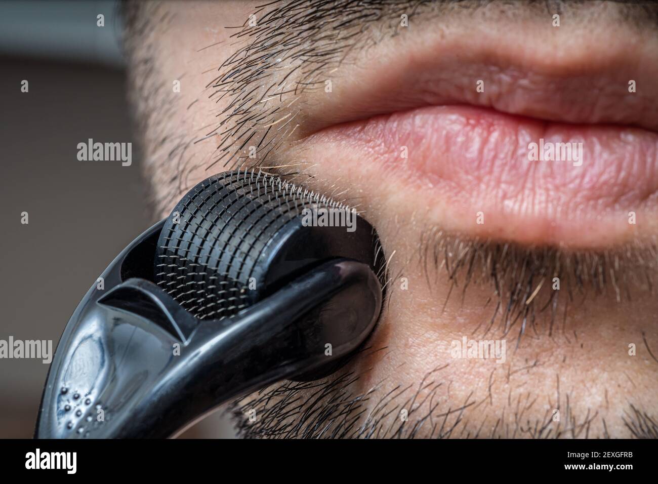 Facial hair care concept. Young man is using derma roller on beard ...